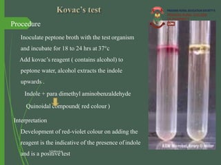 Biochemical test for identification of Bacteria | PPT