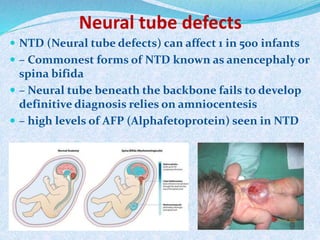 Biochemical markers of prenatal diagnosis | PPTX