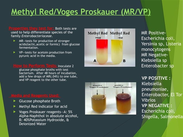 BIOCHEMICAL REACTIONS IN BACTERIOLOGY.pptx
