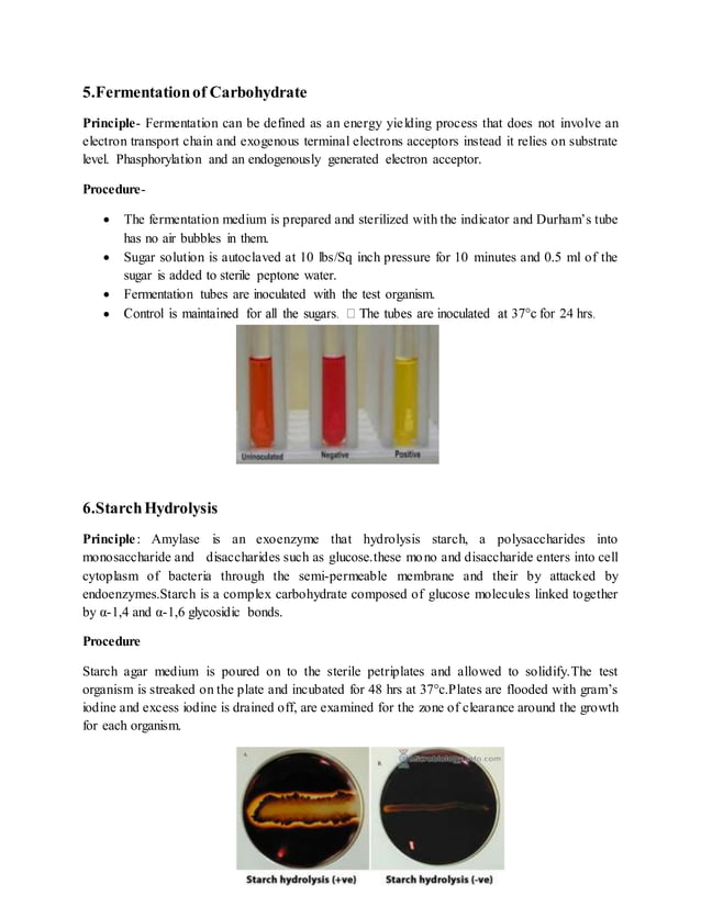 Biochemical tests and physiological tests for various groups of ...