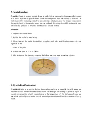 Casein Hydrolysis Test
