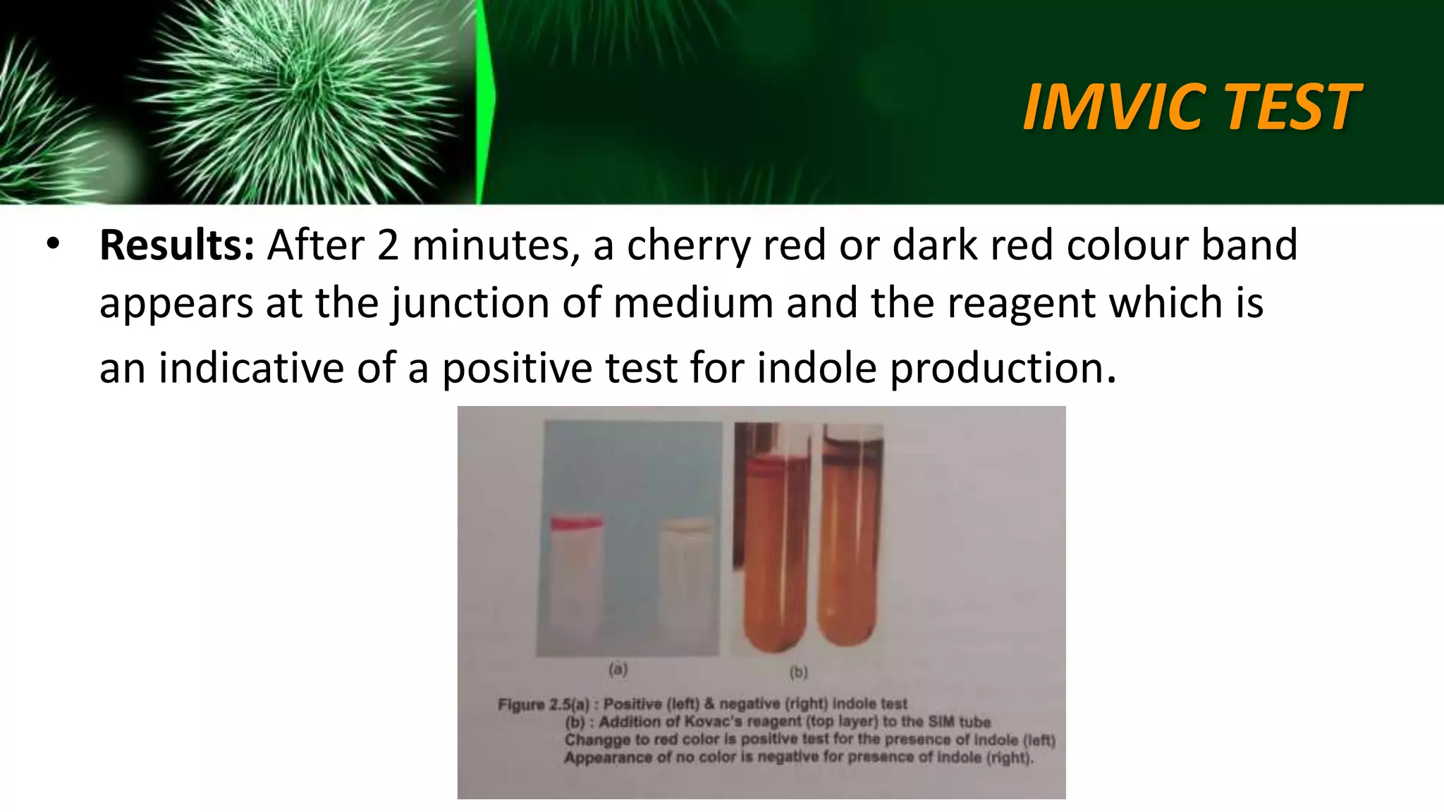biochemical test for identification of bacteria.pptx