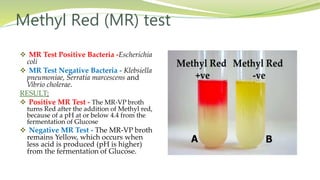 Biochemical test (im vi c) | PPTX