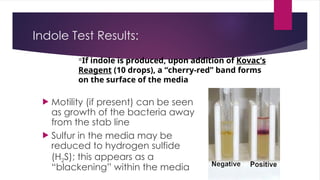 Biochemical Tests for Microbial Identification | PPT
