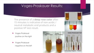 Biochemical Tests for Microbial Identification | PPT