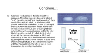 Biochemical test of bacteria. Informatio | PPTX
