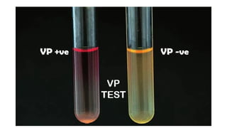 Biochemical test Part-2. follow part wise | PPTX