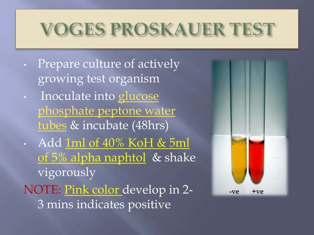 Biochemical tests | PPT