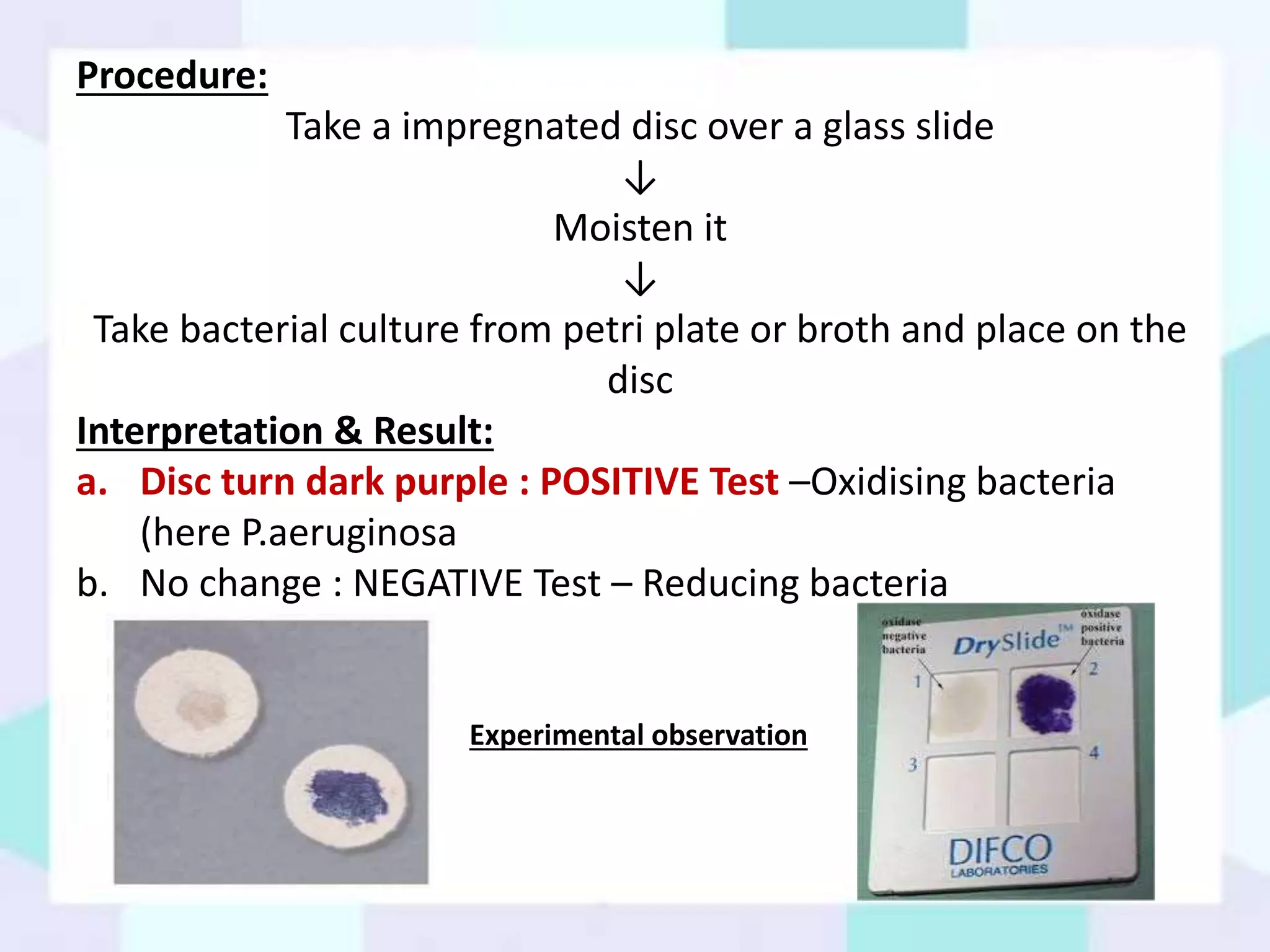 Biochemical tests and serological tests for bacterial disease diagnosis ...