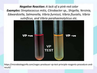 Biochemical tests and serological tests for bacterial disease diagnosis ...