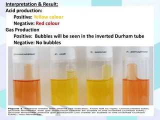 Biochemical tests and serological tests for bacterial disease diagnosis ...