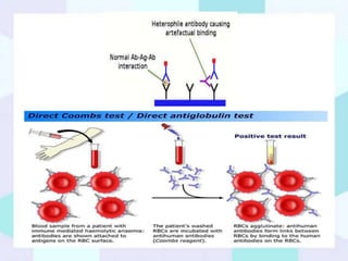 Biochemical tests and serological tests for bacterial disease diagnosis ...