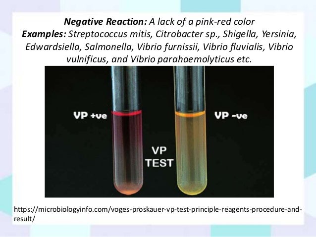 Biochemical tests and serological tests for bacterial disease diagnos…