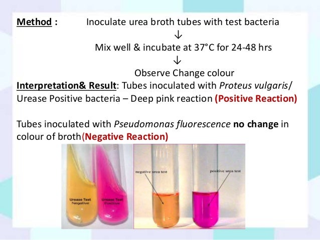 Biochemical tests and serological tests for bacterial disease diagnos…
