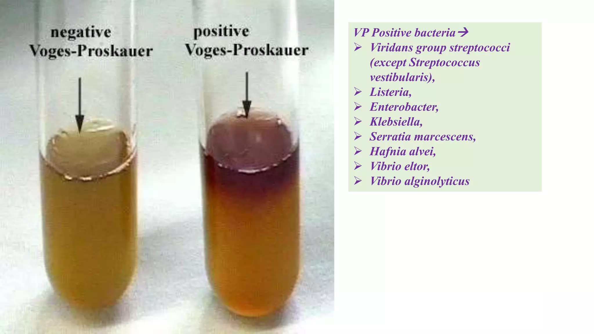 Biochemical tests for bacterial identification | PPTX | Chemistry | Science