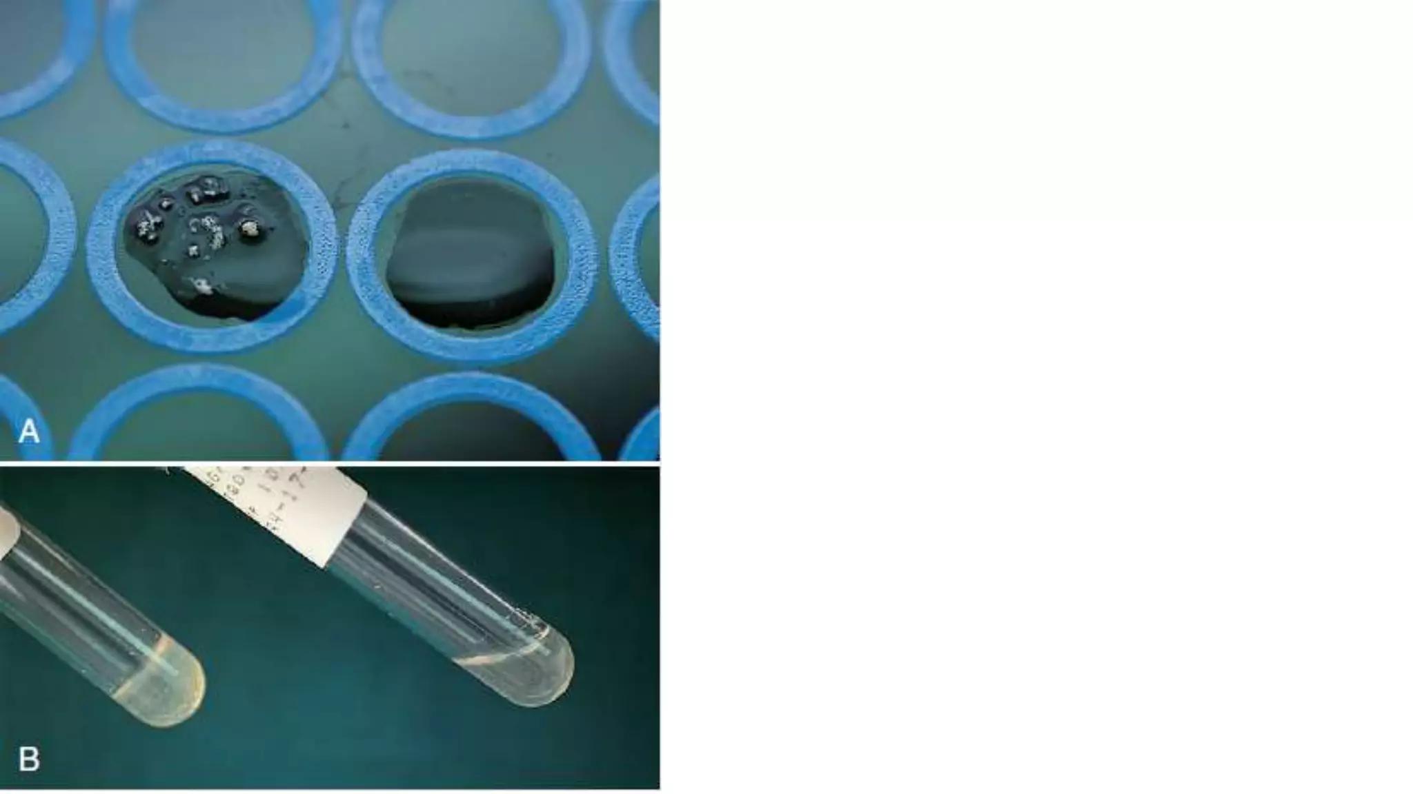 Biochemical tests for bacterial identification | PPTX