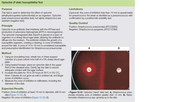 Biochemical tests for bacterial identification | PPTX | Chemistry | Science