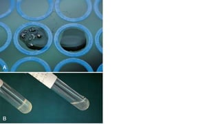 Biochemical tests for bacterial identification | PPTX