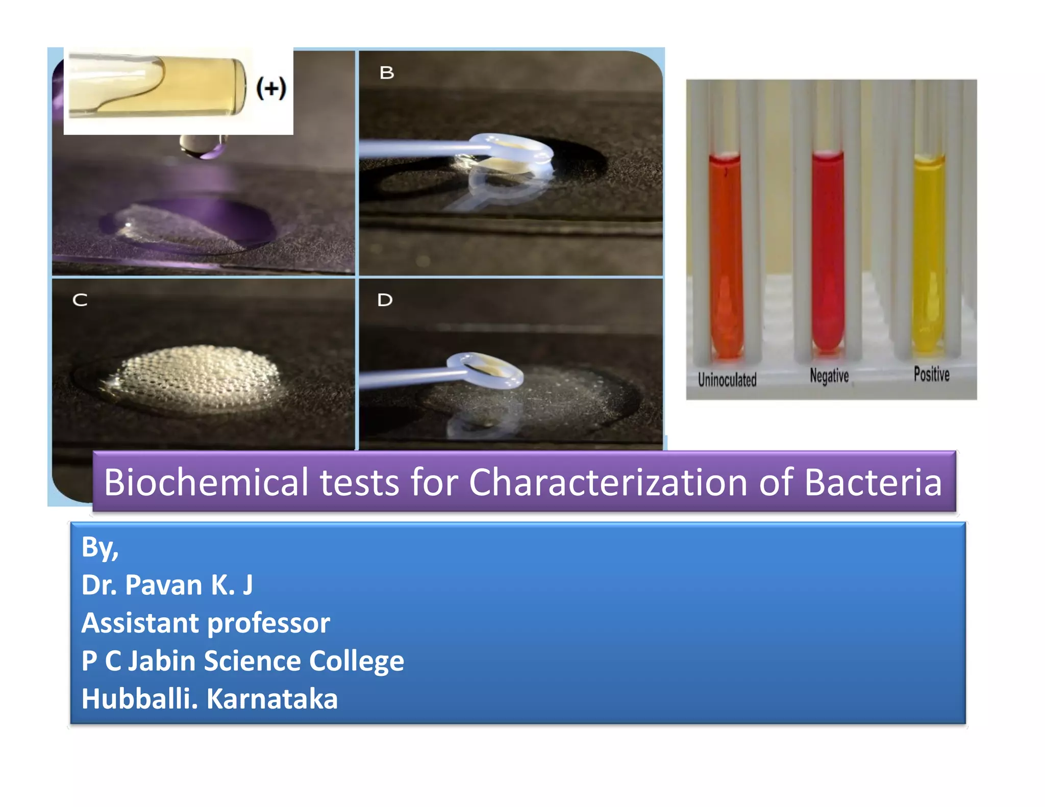 Biochemical tests for characterization of bacteria | PDF