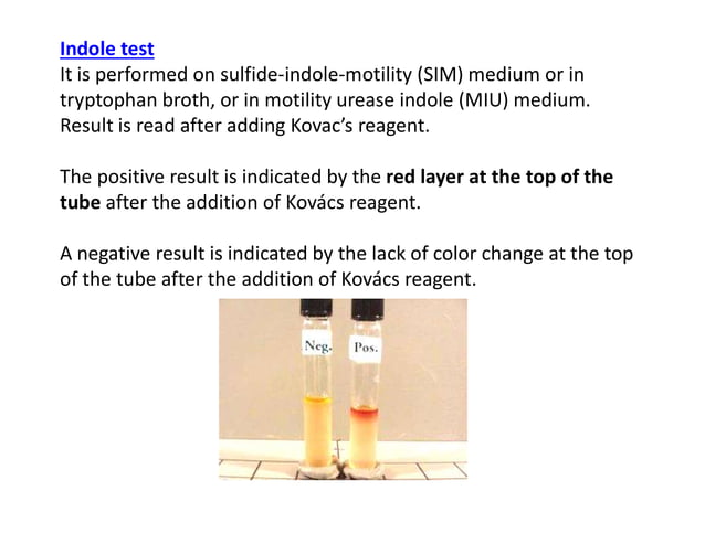 Biochemical tests for characterization of bacteria | PDF