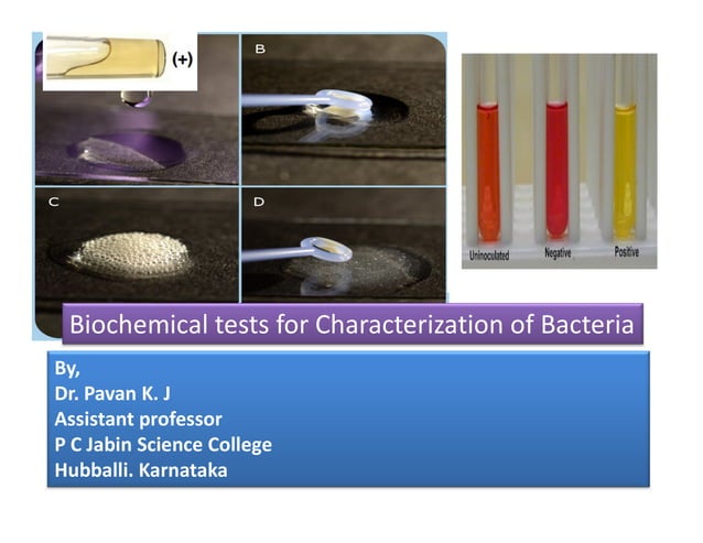 Biochemical Tests To Identify Bacteria