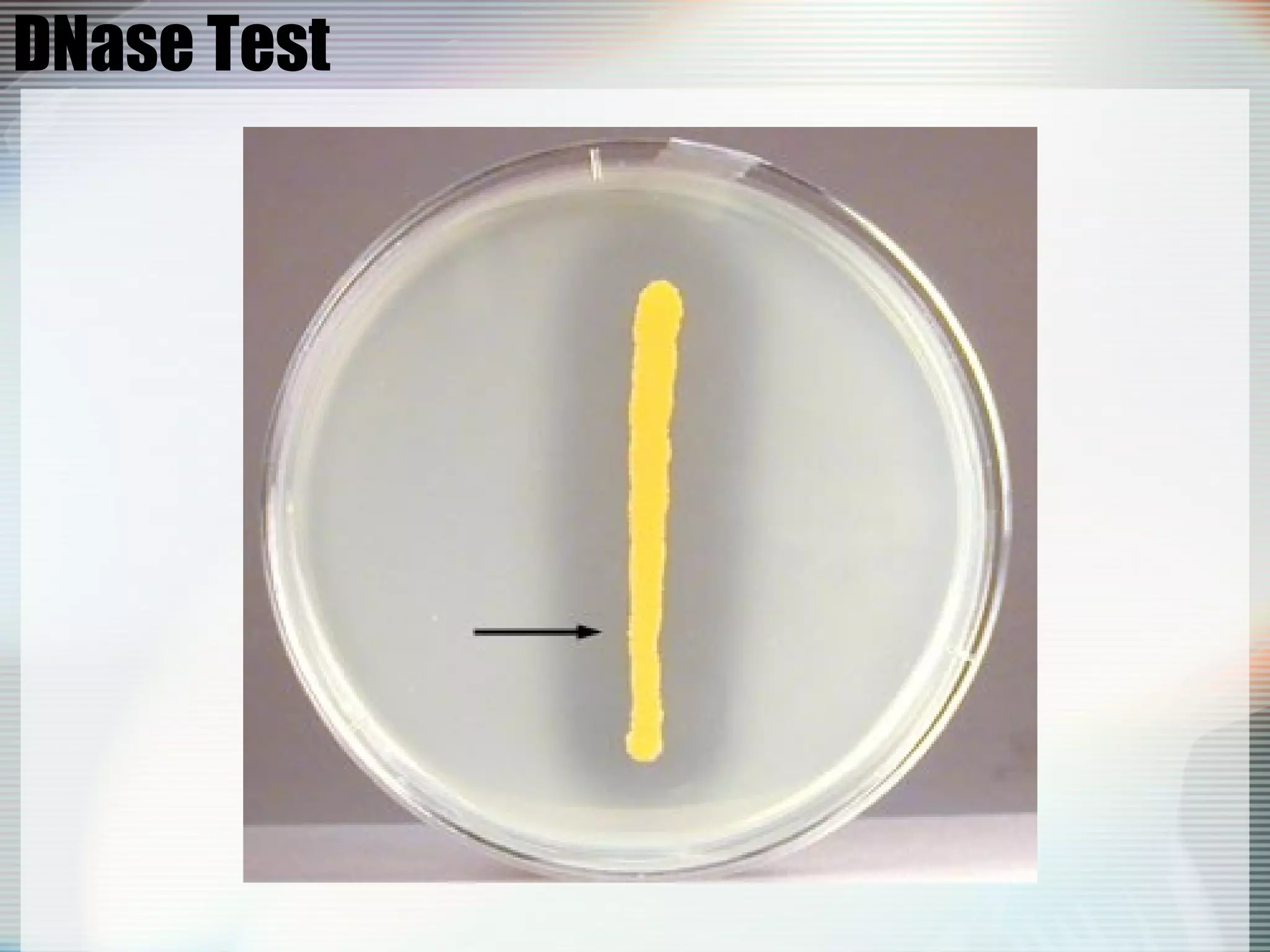 Biochemical tests for gram positive cocci | PPT
