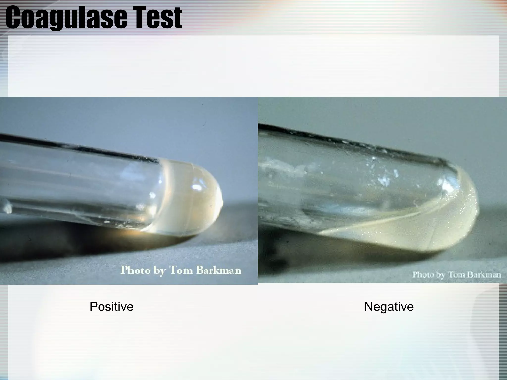 Biochemical tests for gram positive cocci | PPT