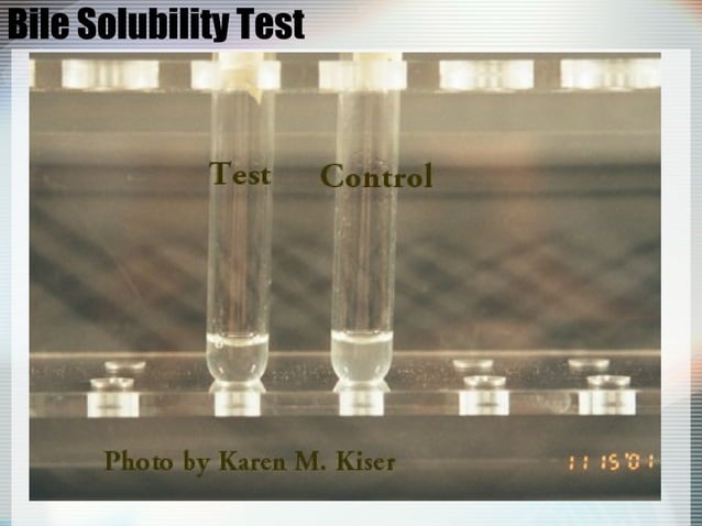 Biochemical tests for gram positive cocci | PPT
