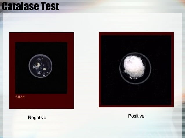 Biochemical tests for gram positive cocci | PPT