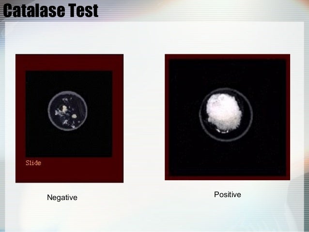 Biochemical tests for gram positive cocci