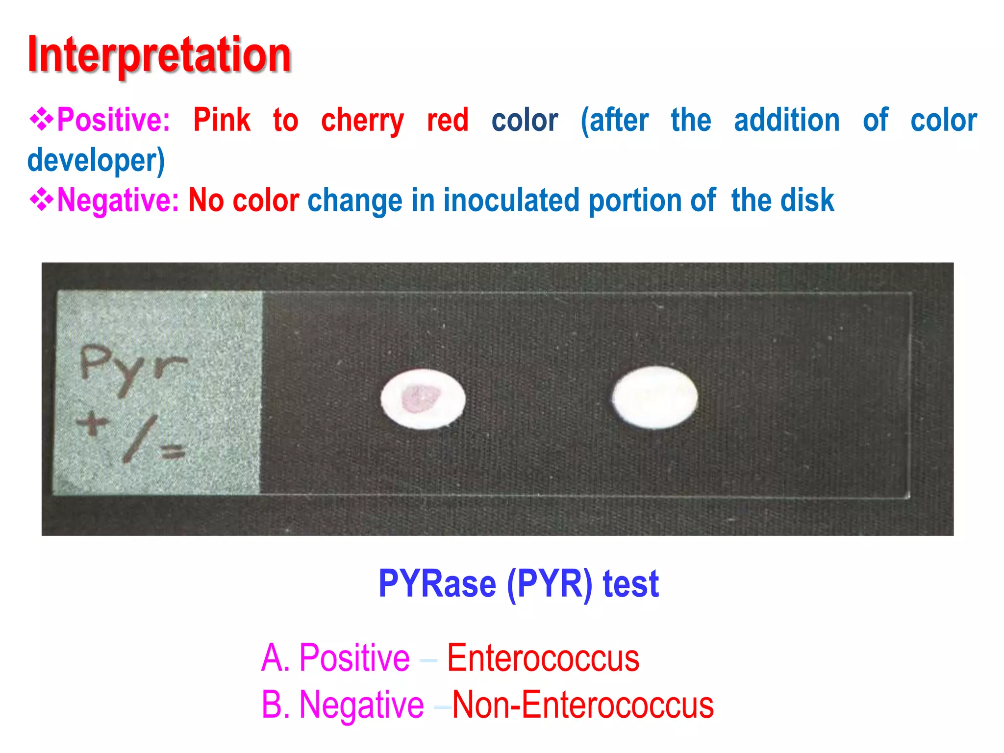 Biochemical tests for identification of bacteria | PPT