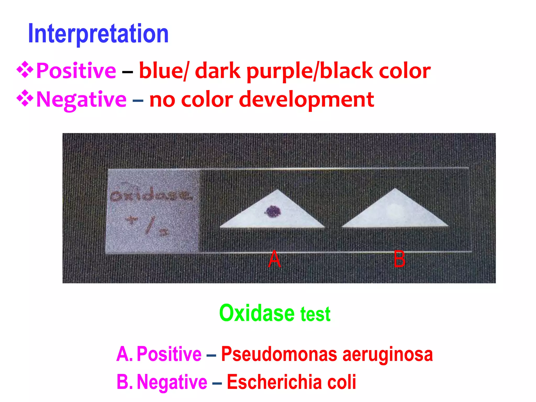 Biochemical tests for identification of bacteria | PPT