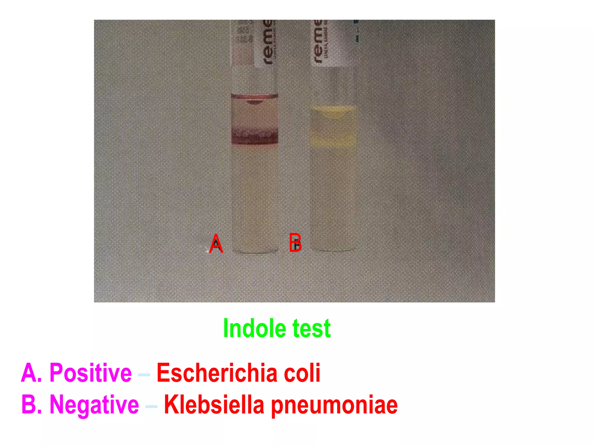 Biochemical tests for identification of bacteria | PPT | Blood ...
