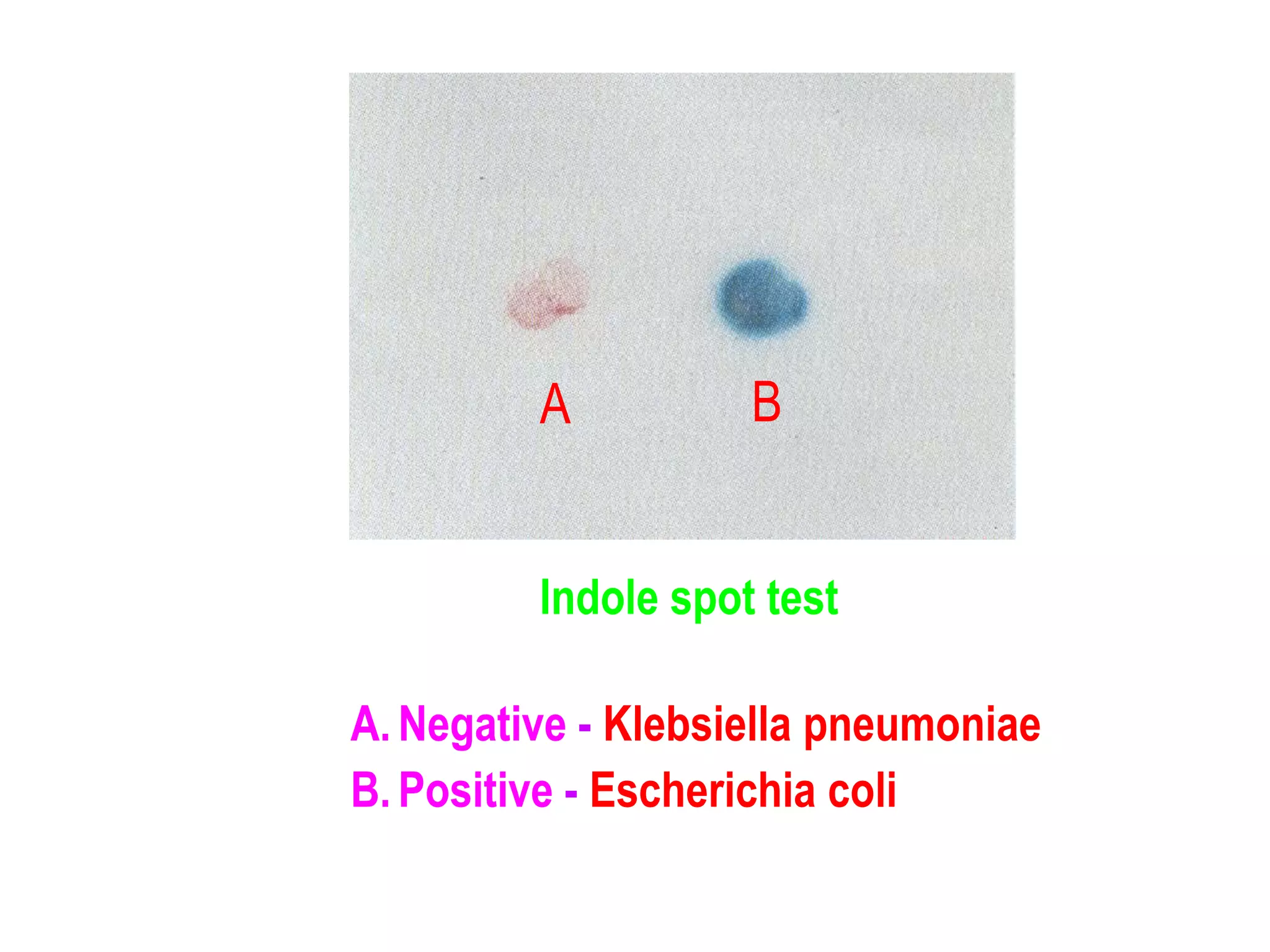 Biochemical tests for identification of bacteria | PPT