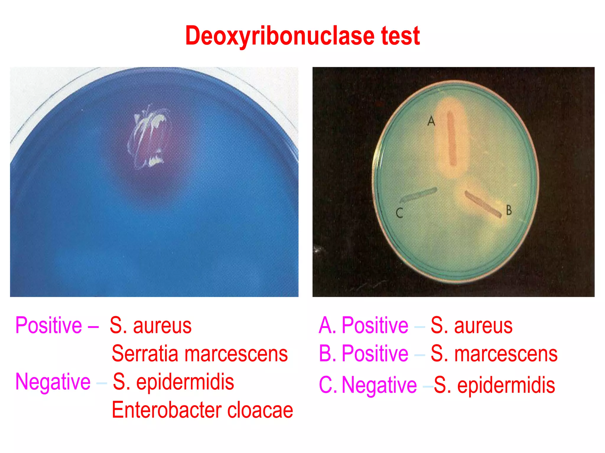 Biochemical tests for identification of bacteria | PPT | Blood ...
