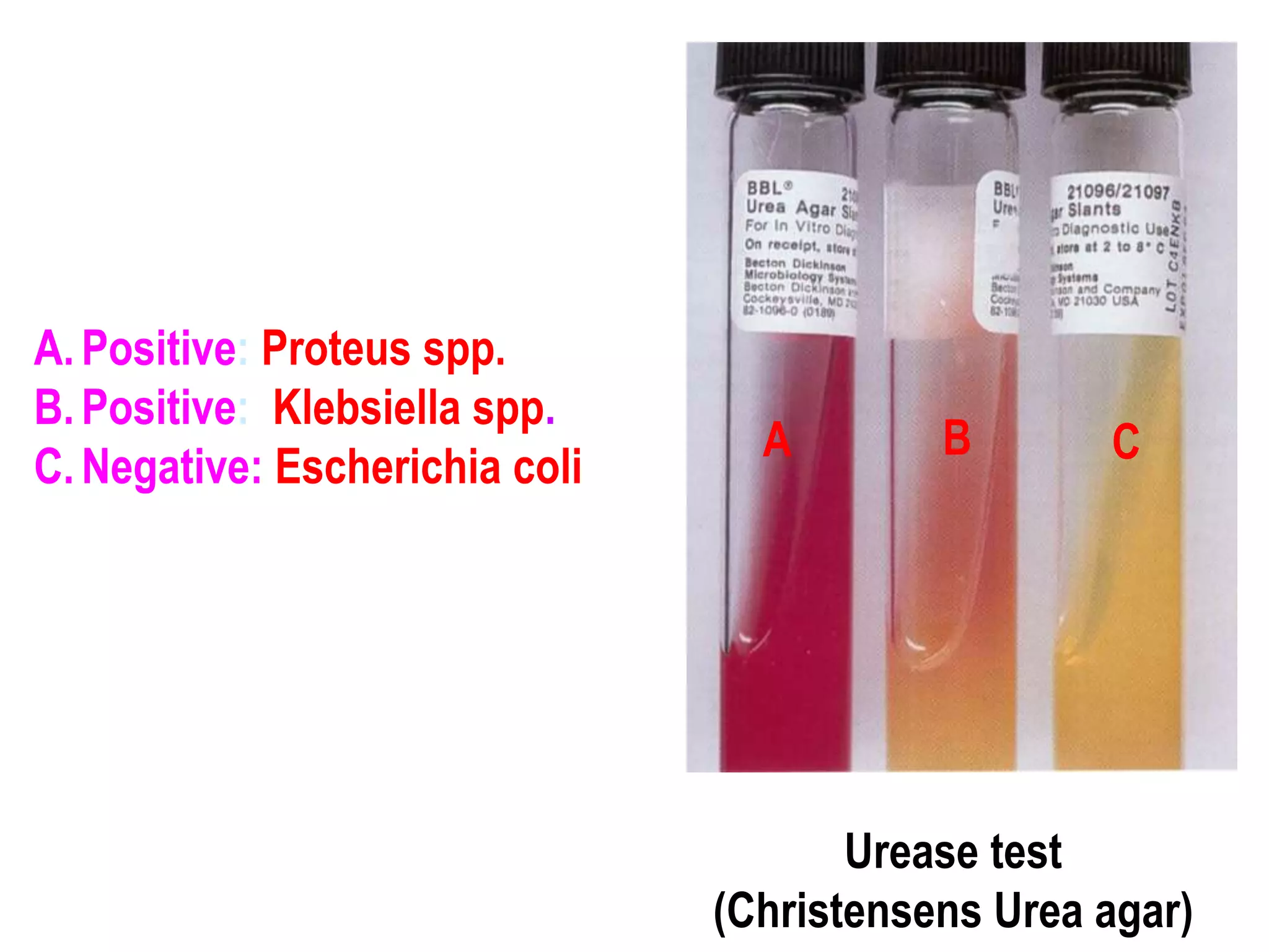 Biochemical tests for identification of bacteria | PPT