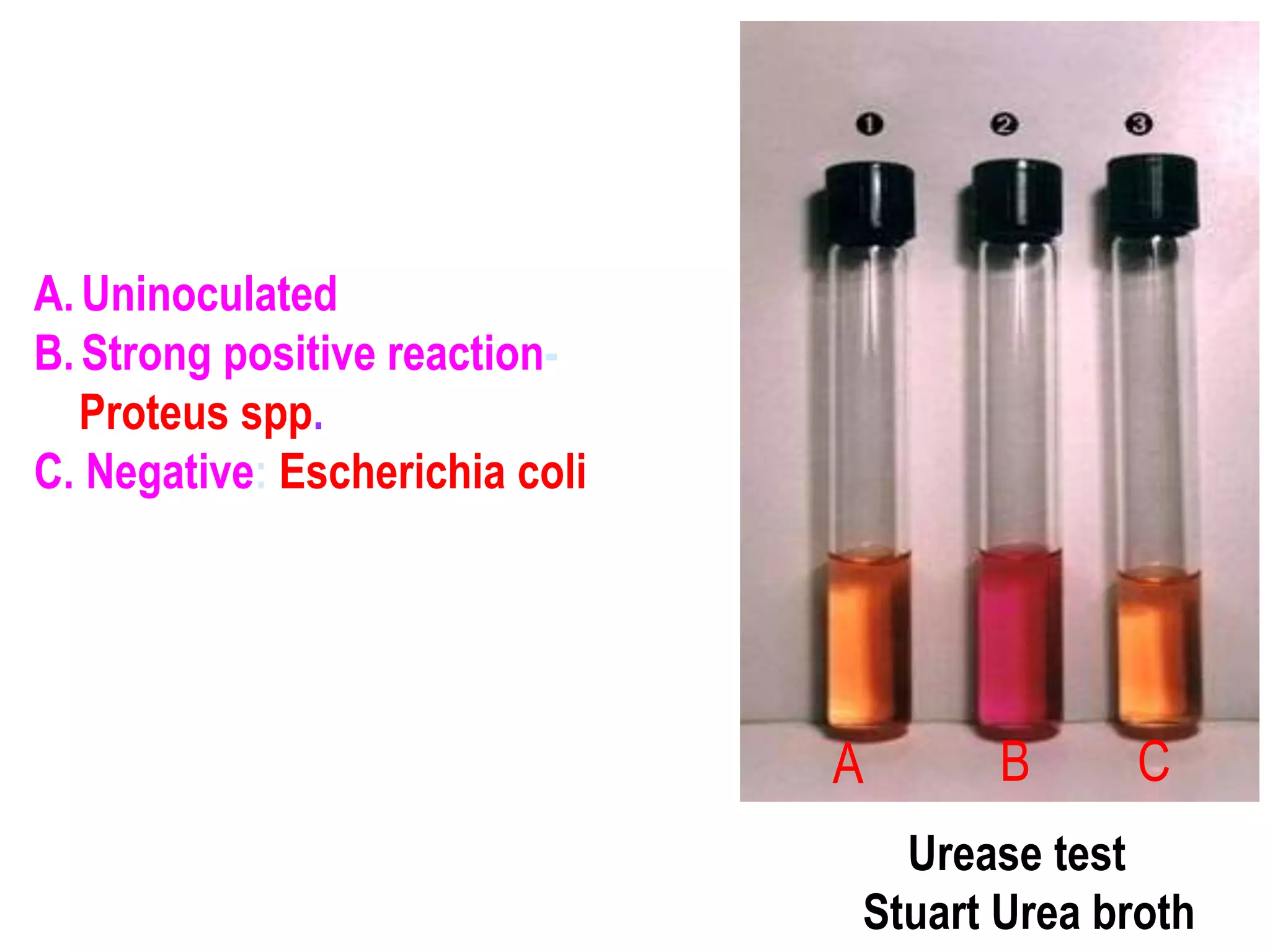 Biochemical tests for identification of bacteria | PPT