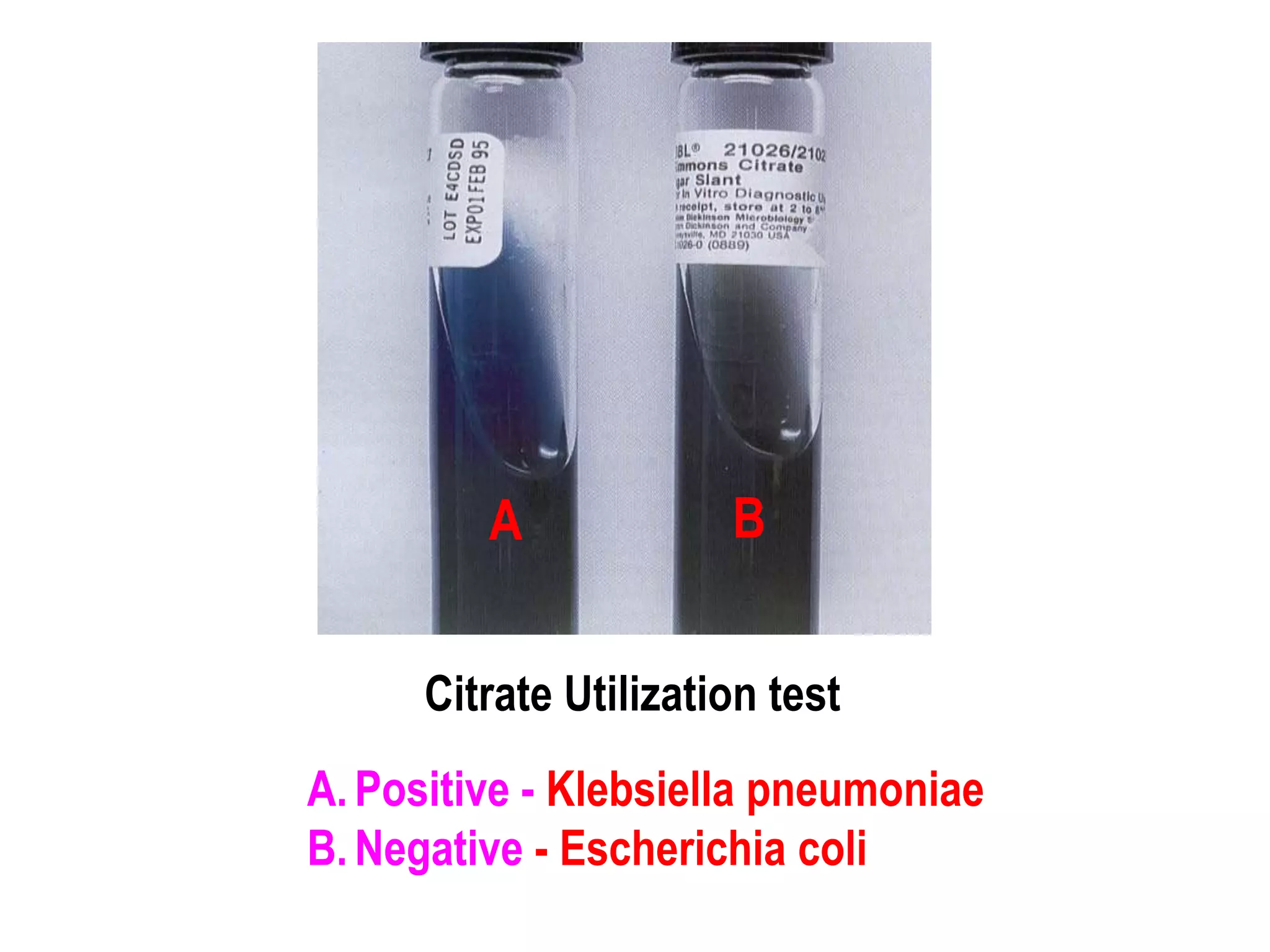 Biochemical tests for identification of bacteria | PPT