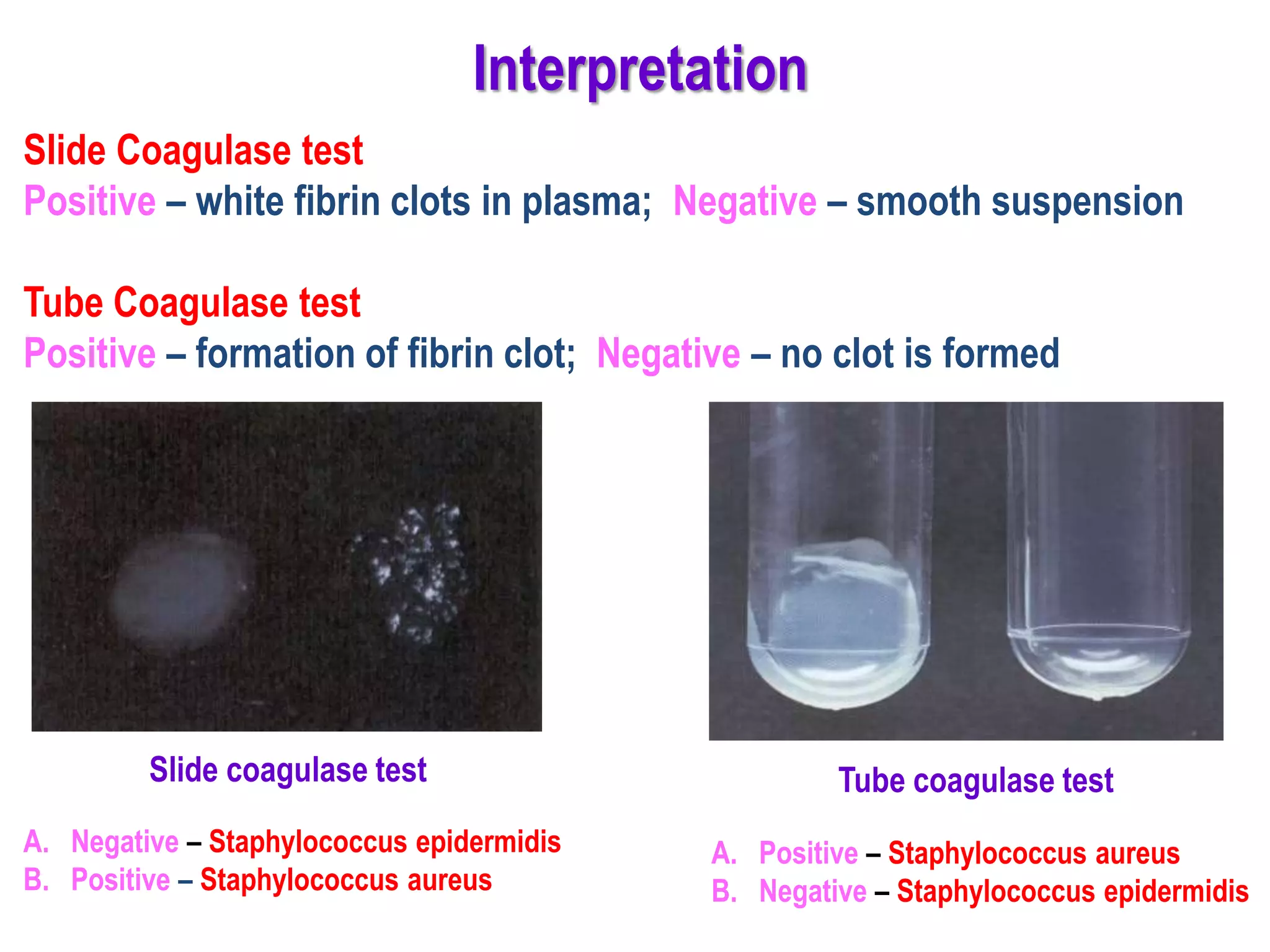 Biochemical tests for identification of bacteria | PPT