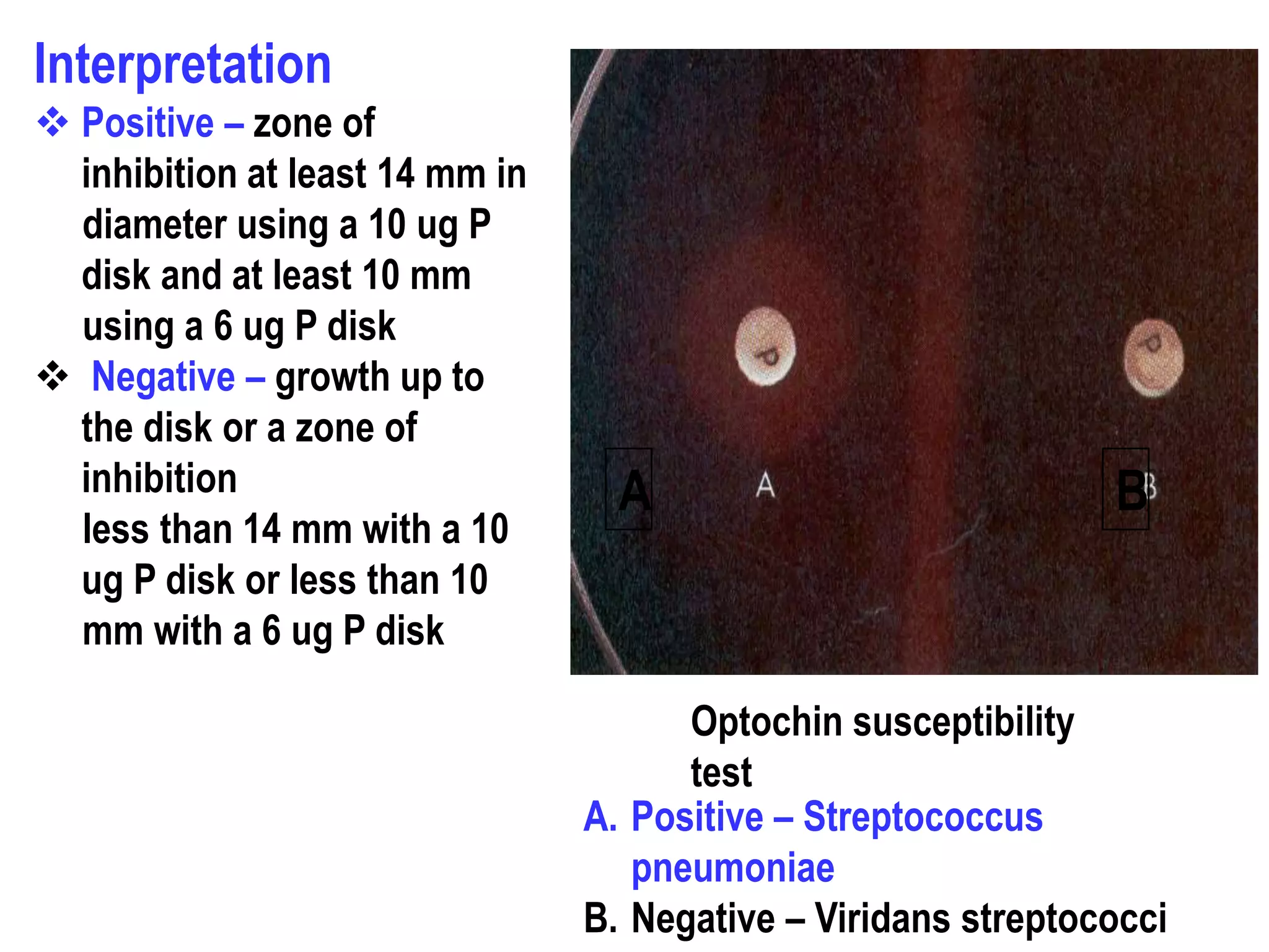 Biochemical tests for identification of bacteria | PPT