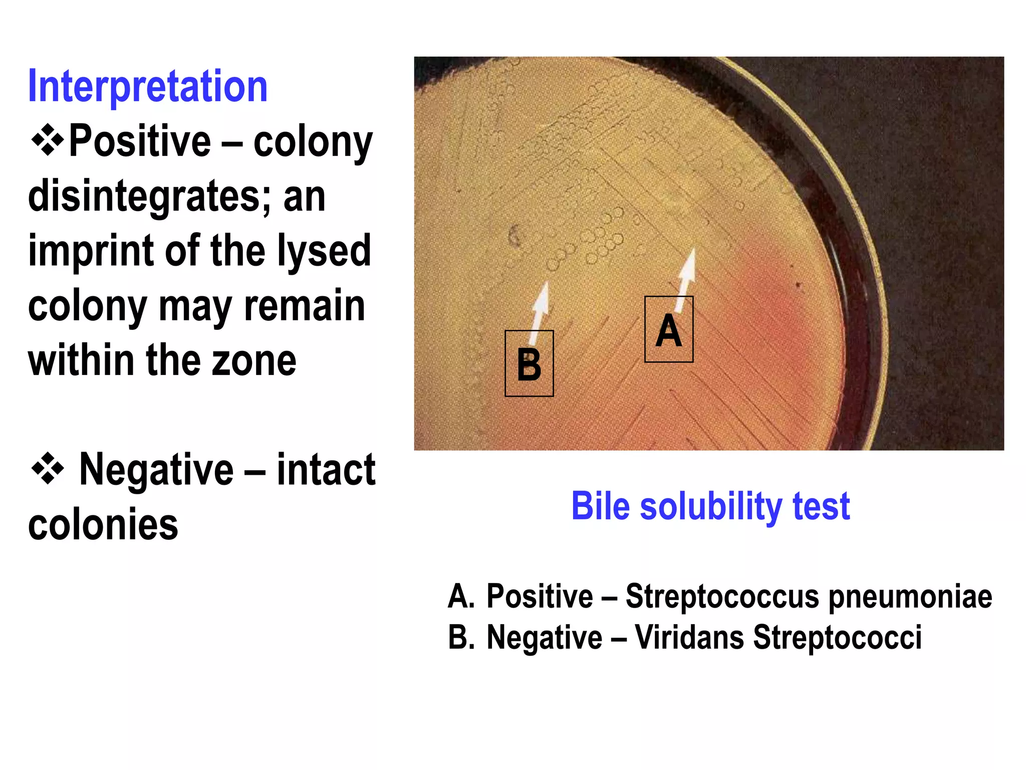 Biochemical tests for identification of bacteria | PPT