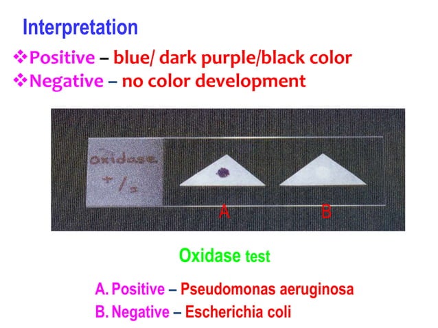 Biochemical tests for identification of bacteria | PPT | Blood ...
