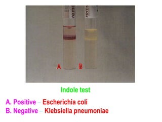 Biochemical tests for identification of bacteria | PPT