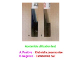 Biochemical tests for identification of bacteria | PPT
