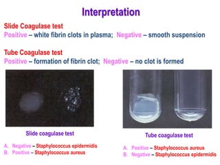 Biochemical tests for identification of bacteria | PPT