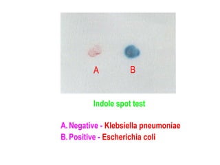 Spot Indole Negative
