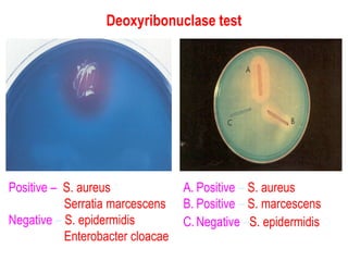Enterobacter Cloacae Catalase Test