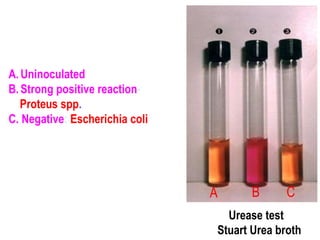 Nitrate Reduction Test E Coli