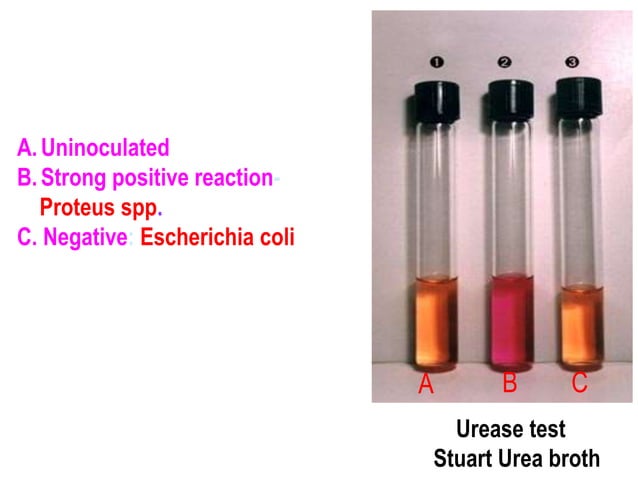 Biochemical tests for identification of bacteria | PPT