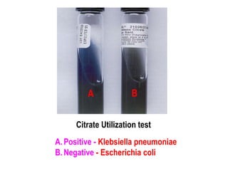 Citrate Test E Coli